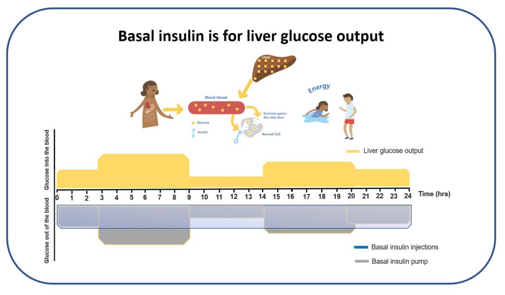 Basal Insulin in Type 1 Diabetes — Key Guide | GNL