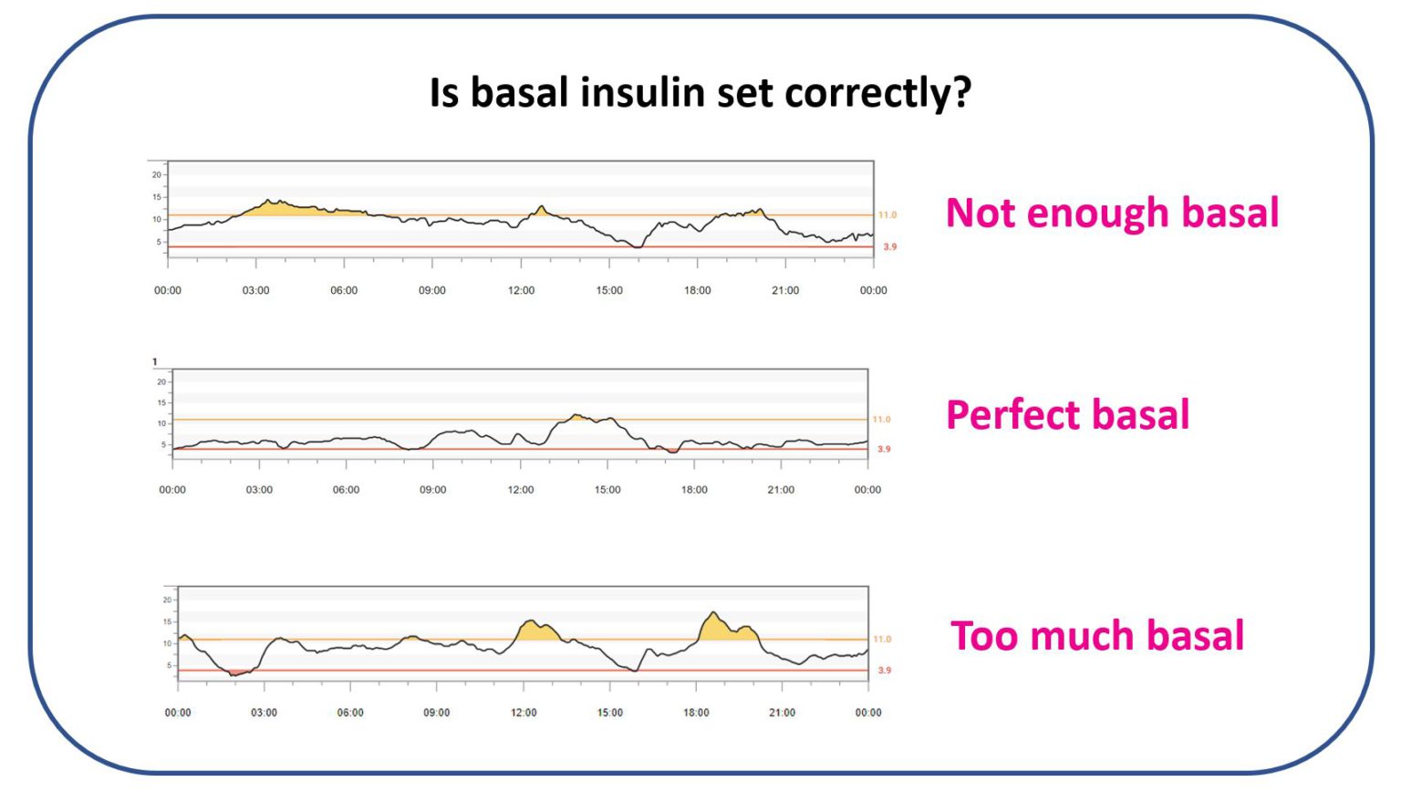 Basal Insulin in Type 1 Diabetes — Key Guide | GNL