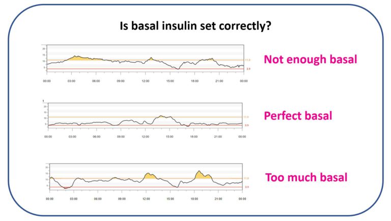 Basal Insulin in Type 1 Diabetes — Key Guide | GNL