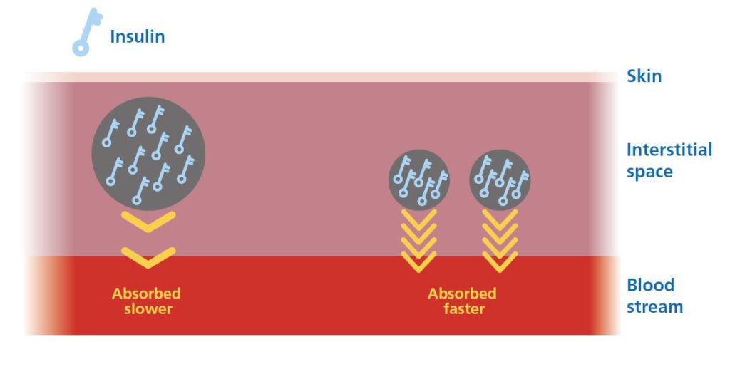 Bolus Insulin in Type 1 Diabetes — Key Guide | GNL