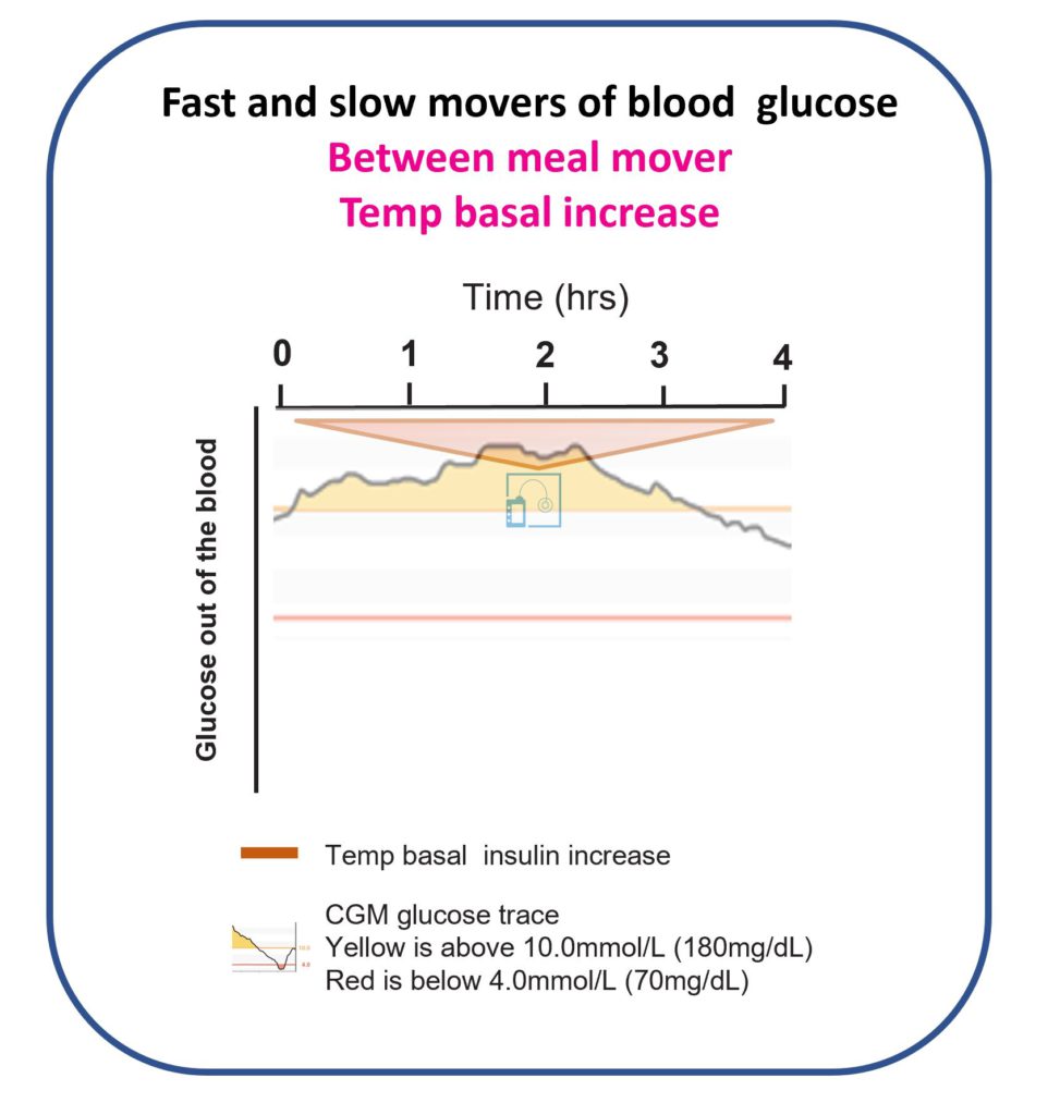 Basal Insulin in Type 1 Diabetes — Key Guide | GNL