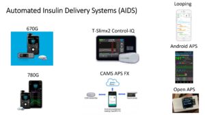 Automated Insulin Delivery Systems (AIDS) - The Glucose Never Lies