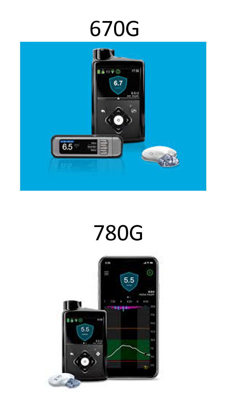 Tips & tricks: 670G & 780G - The Glucose Never Lies®